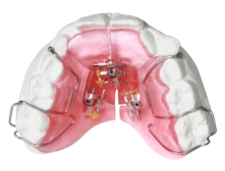 Photo Albums – Gergen's Orthodontic Lab