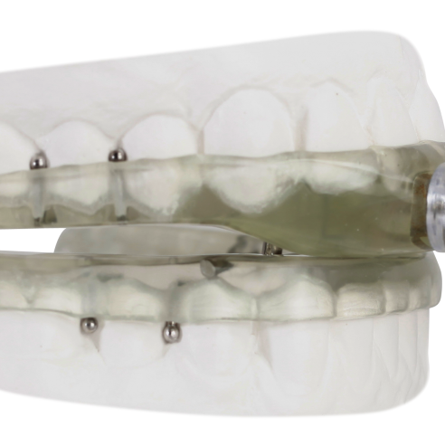 TMJ & Sleep Appliances – Gergen's Orthodontic Lab