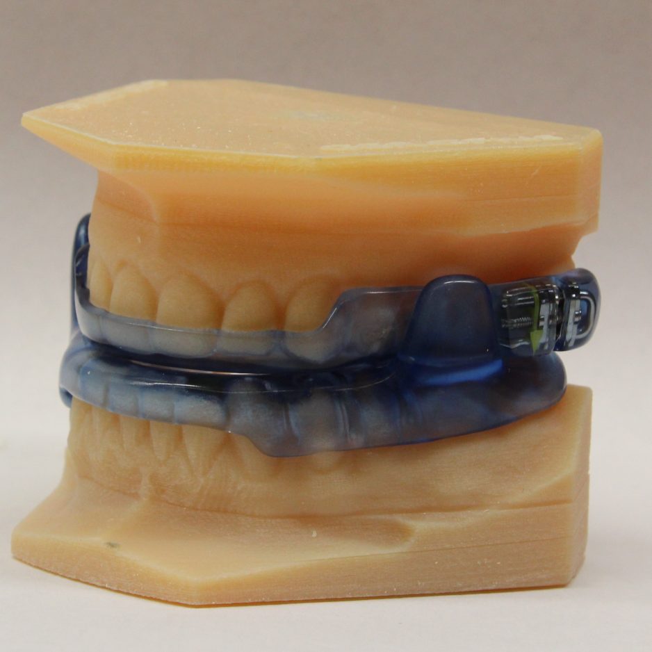 Orthodontics and TMJ & Sleep Appliances – Gergen's Orthodontic Lab